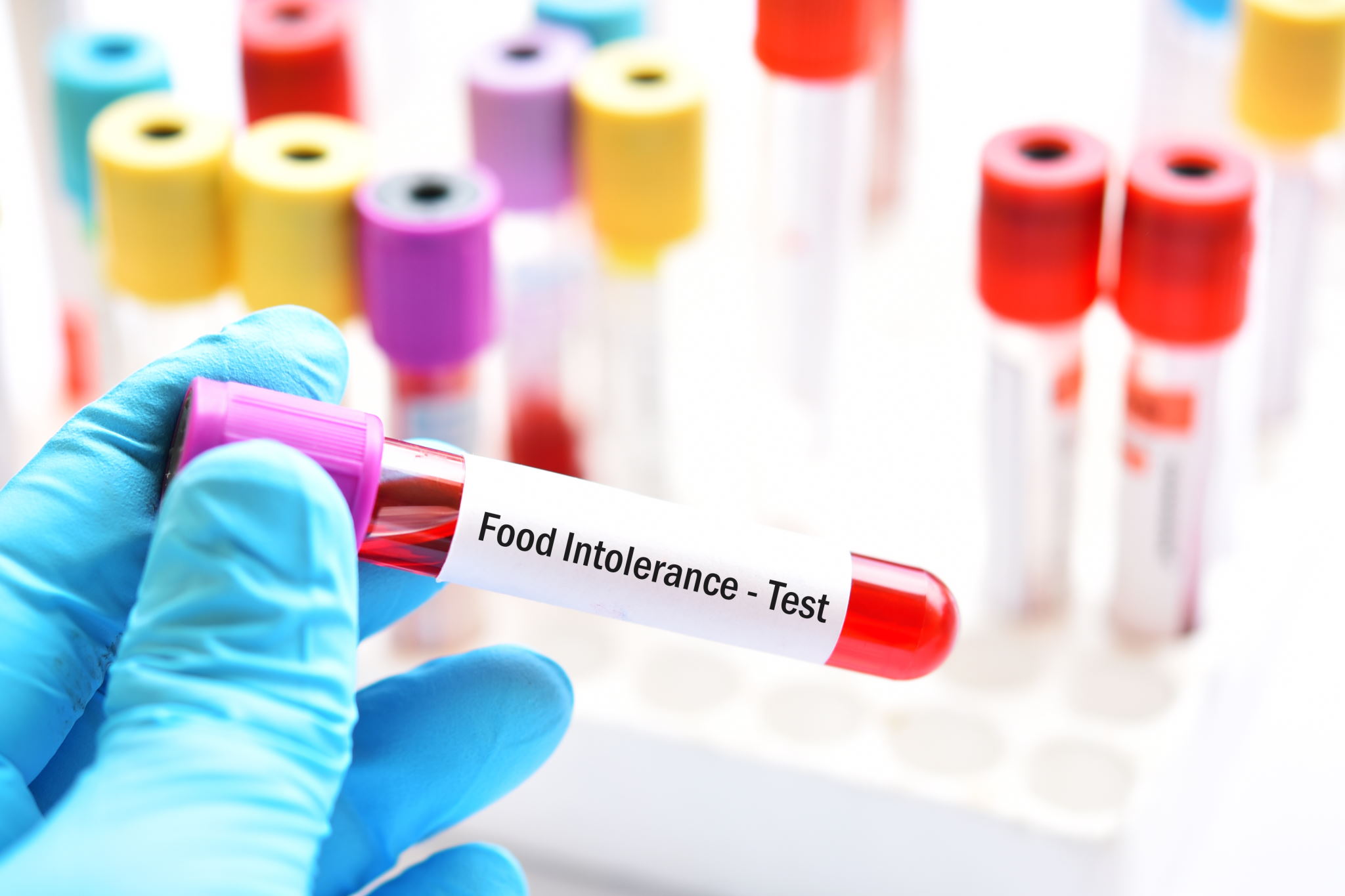 Everything you need to know about Food Intolerance Tests - Live More
